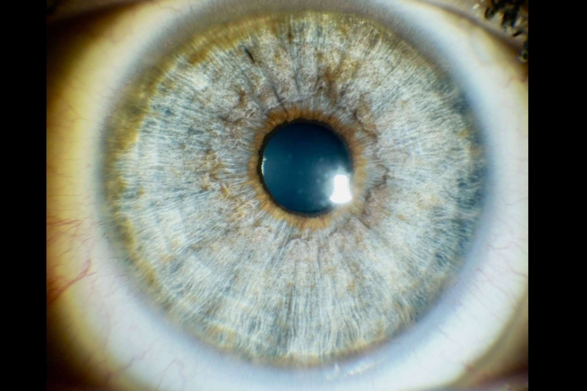 Eyecos responde a las preguntas más frecuentes sobre el cambio de color ...